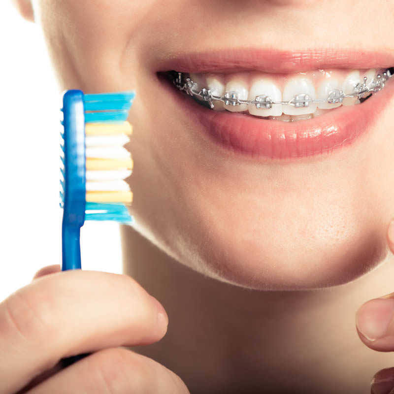 Teeth Straightening | Braces |Oxford Place Dental